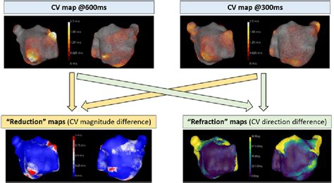 Figure 1 From Charge Density Mapping To Evaluate Non Pulmonary Vein Substrate In Patients With