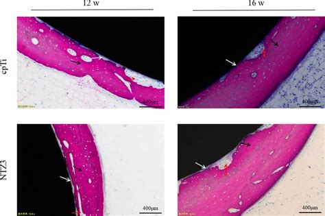 Histological Signs Of Bone Formation Around The Implant Surface