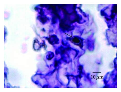 Osteocyte With Cytoplasm Extensions Inside Matrix Of Human Fetus At 16
