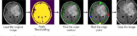 Figure 2 From Mri Based Brain Tumor Classification Using Ensemble Of