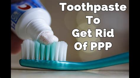 Pearly Penile Papules Removal Toothpaste Asking List