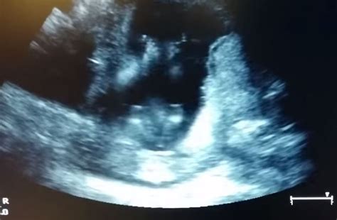 El tierno bebé que aplaude al ritmo de la música en el vientre de su madre