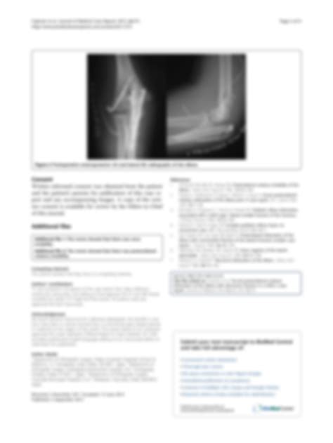 Solution Occult Posterolateral Rotatory Dislocation Of The Elbow With
