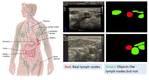 Review Cfs Fcn Biomedical Image Segmentation By Sik Ho Tsang Datadriveninvestor