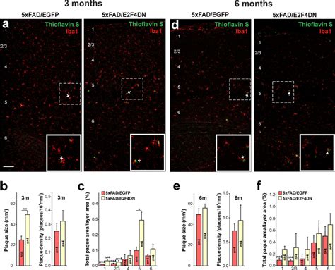 Modulation Of Aβ Deposition By E2f4dn In The Cerebral Cortex Of 5xfad