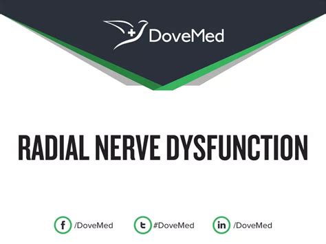 Radial Nerve Dysfunction Dovemed