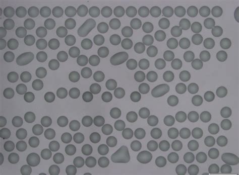 How To Count Objects In Image Using Python Stack Overflow