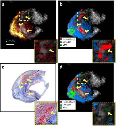 Figure 1 From Deep Learning Assisted Classification Of Spectral Photoacoustic Imaging Of Carotid