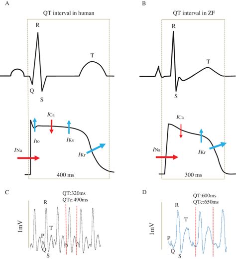 Essential Electrocardiographic Parameters Including P Wave QRS