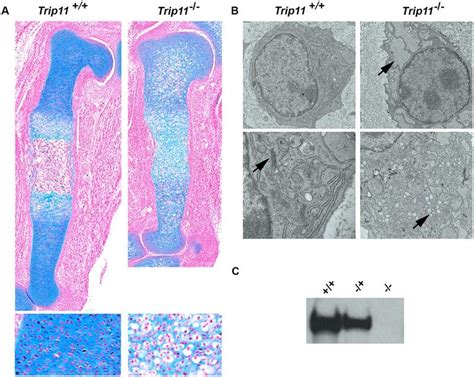 Swelling Of Er Cisternae And Disruption Of The Golgi Stack Structure In Download Scientific