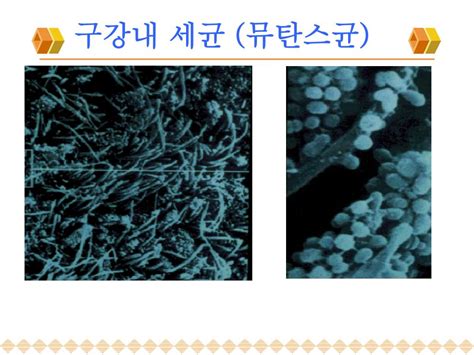 Ppt 충치의 원인과 예방법 알기 Powerpoint Presentation Free Download Id5961115
