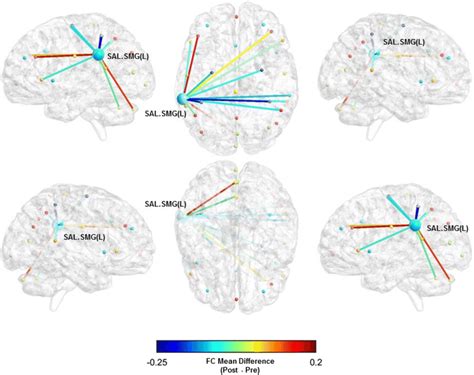 Functional Connectivity Mean Difference Between The Left Supramarginal