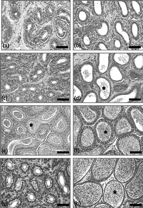 Histological Sections Of The Caput And Cauda Epididymis Of Yellowish
