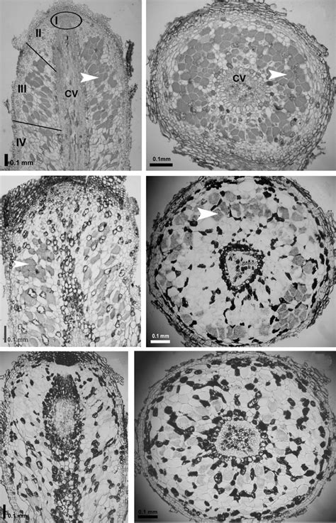 In Situ Localization Of Eunod Chi Transcripts In Root Nodules Of E