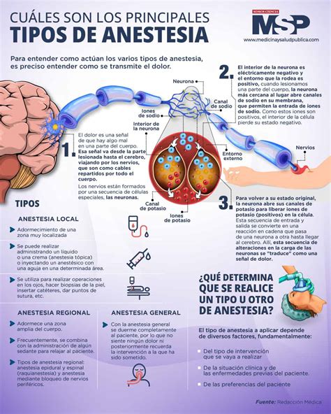 Cuales Son Los Principales Tipos De Anestesias Infograf A Hot Sex Picture