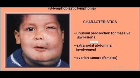 Viral Oncogenesis Youtube
