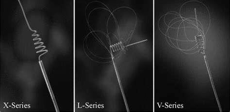 Intra Arterial Therapy For Acute Ischemic Stroke Neupsy Key