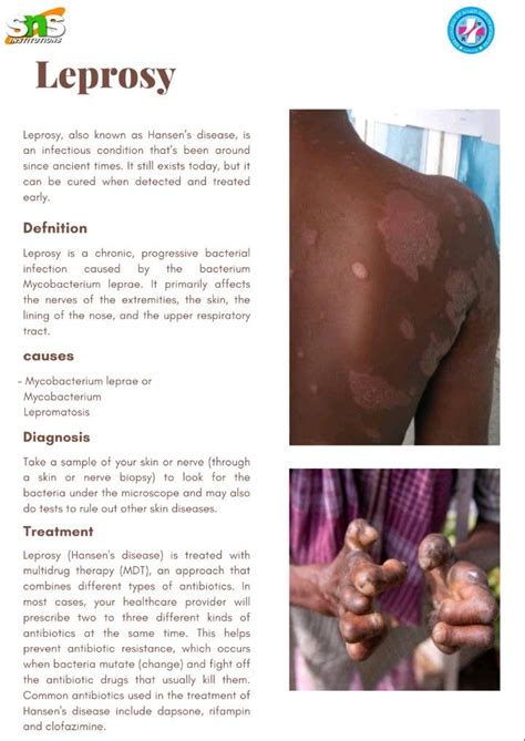 Rameesa Km On Linkedin Snsdesignthinking Snsdesignthinkers Snsinstitutions