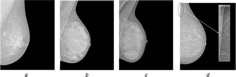 Results Of Proposed Pmb Detection Algorithm Shown By Solid Linealong