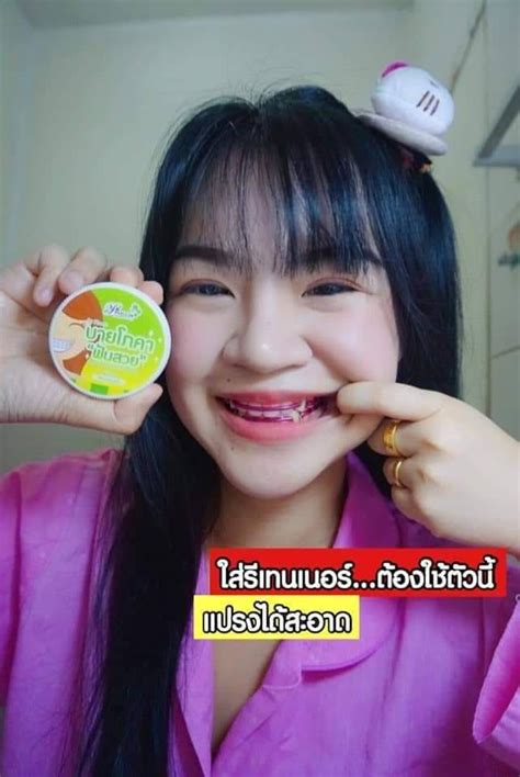 สาวๆจัดฟัน ยาสีฟันสมุนไพลบายโภคารายใหญ่ปลีก ส่ง
