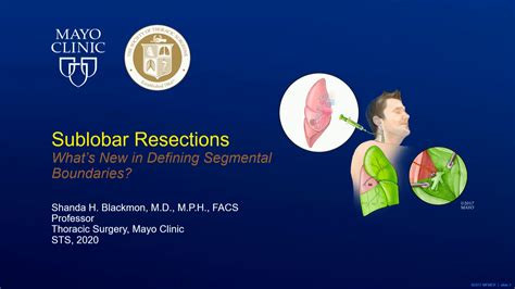 Sublobar Resection Whats New In Defining Segment Boundaries