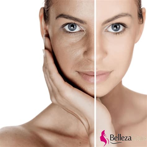 Non Invasive Skin Tightening Beauty Machine Supplier