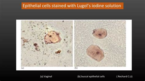 Vaginal Fluid Analysis Forensic Biology Pptx