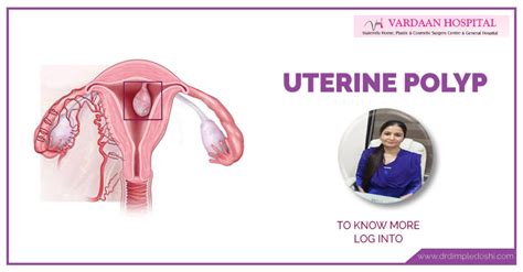 Uterine Polyps Treatment In Goregaon West Mumbai
