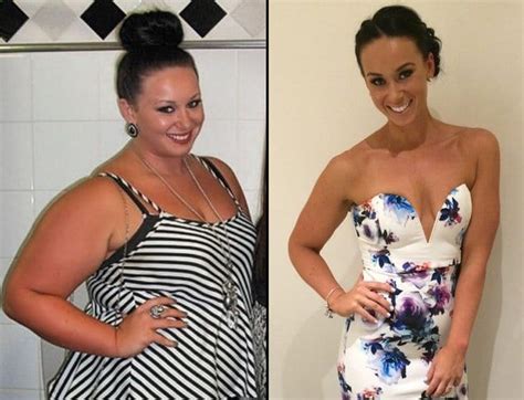 Before And After Weight Loss No Surgery Weight Loss Wall