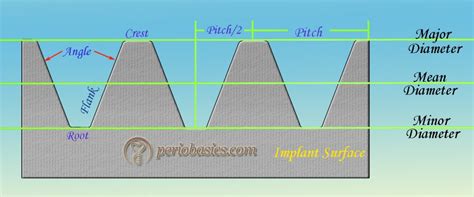 Dental Implant Components And Current Concepts In Implant Design
