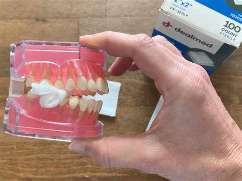 When To Stop Using Gauze After Tooth Extraction