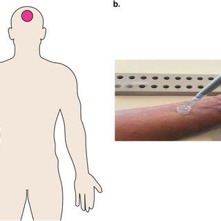 Overview Of Sampling Procedure Used In This Study A Standardized Download Scientific Diagram