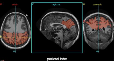 Lecture 12 Multimodal Integration Ii Cortical Focus Flashcards