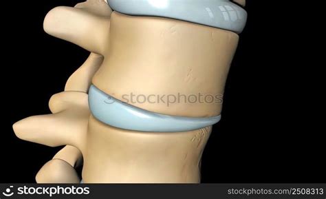 Spinal Cord Normal Intervertebral Disc 3d Illustration Spinal Cord