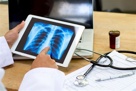 Pneumocystoza Przyczyny Objawy Leczenie Wylecz To