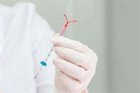 Late Period After Iud Removal 6 Best Reasons Explained