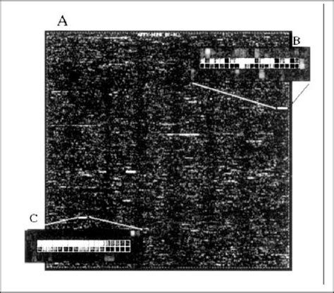 Scanned Image Of An Oral Cancer Sample Hybridized To The Hugenefl