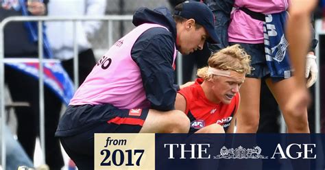 Afl Melbourne Demons Defender Josh Wagner To Miss 4 6 Weeks