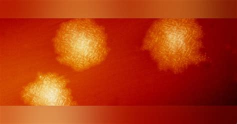 Multistep Algorithm Testing Accurately Identifies C Diff Patients Who