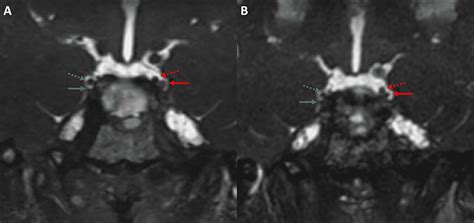 3d Ciss Sequence Obtained Along With The Images In Figure 1 A And 10