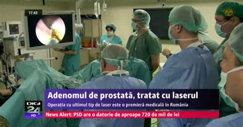 PremierĂ În RomÂnia Adenomul De Prostată Tratat Cu Laserul Digi24
