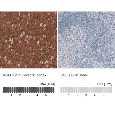 Vglut2 Monoclonal Antibody Cl2921 Ma5 31378