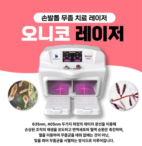 지긋지긋한 발톱무좀 강력한 만족스러운 치료 효과적인 발톱무좀치료법 꿀팁공유 레이져치료 횟수 기간 치료잘하는 병원 비용절감방법