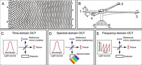 Spectral Oct Retina