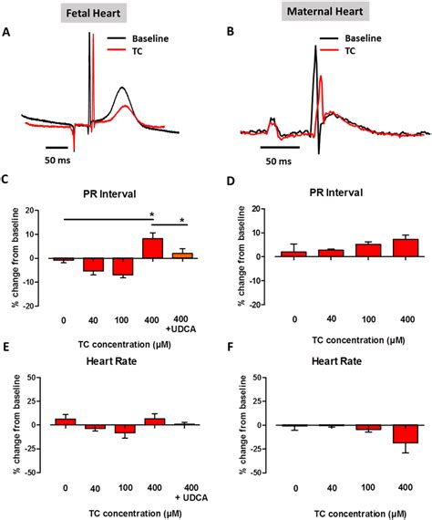 Effect Of Tc On Pr Interval And Heart Rate In Fetal And Maternal Download Scientific Diagram