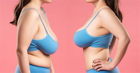 Reducción De Senos Motivos Por Los Que Hay Mujeres Que Eligen Esta