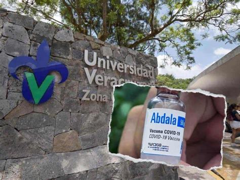 Aplican Vacuna Abdala Contra Covid 19 A Trabajadores De La UV En Xalapa