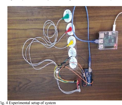 Figure 1 From Iot Based Low Cost Distant Patient Ecg Monitoring System Semantic Scholar