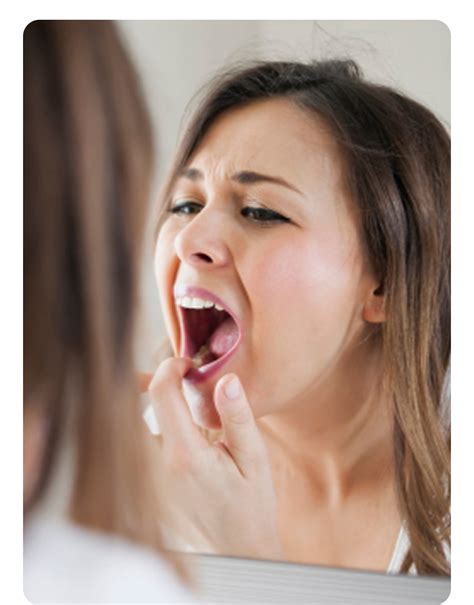 Bleeding Gums Causes Relief And When To Get Help Aspen Dental