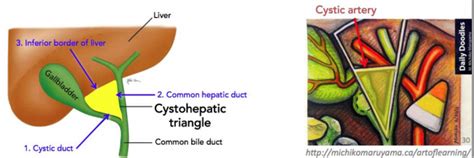 Cystohepatic Triangle